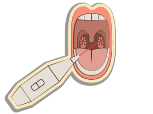 Understanding Adenoid Glands And Their Issues