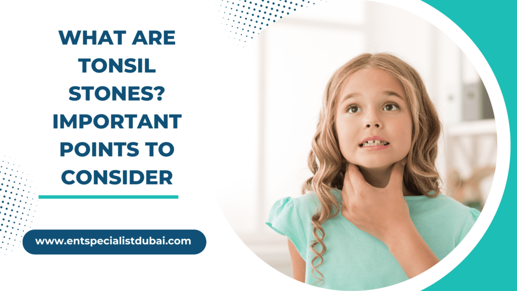 What Are Tonsil Stones? Important Points to Consider - Dr Peter ...